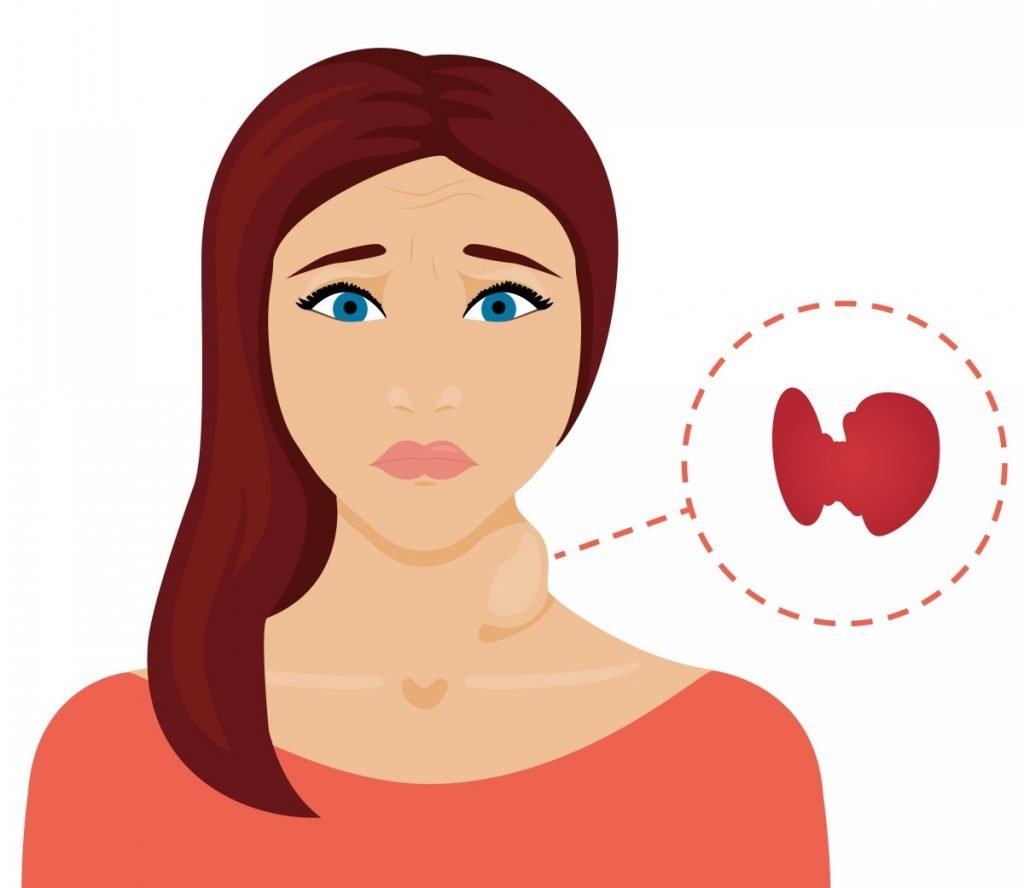 Hyperthyroidism - Dr Subodh Banzal